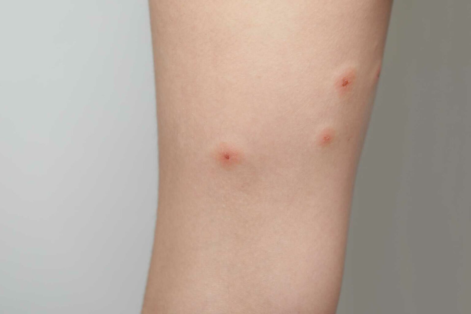 7 Easy DIY Bed Bug Prevention Tips | Van Den Berge Pest Control